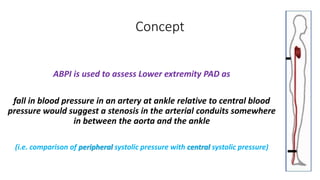 Understanding Ankle Brachial Pressure Index (ABPI) In