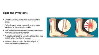 Ankle and Foot Pathology & Interventions: Clinical Features, Diagnosis ...