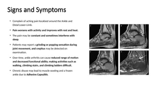 Ankle and Foot Pathology & Interventions: Clinical Features, Diagnosis ...