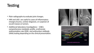 Ankle and Foot Pathology & Interventions: Clinical Features, Diagnosis ...