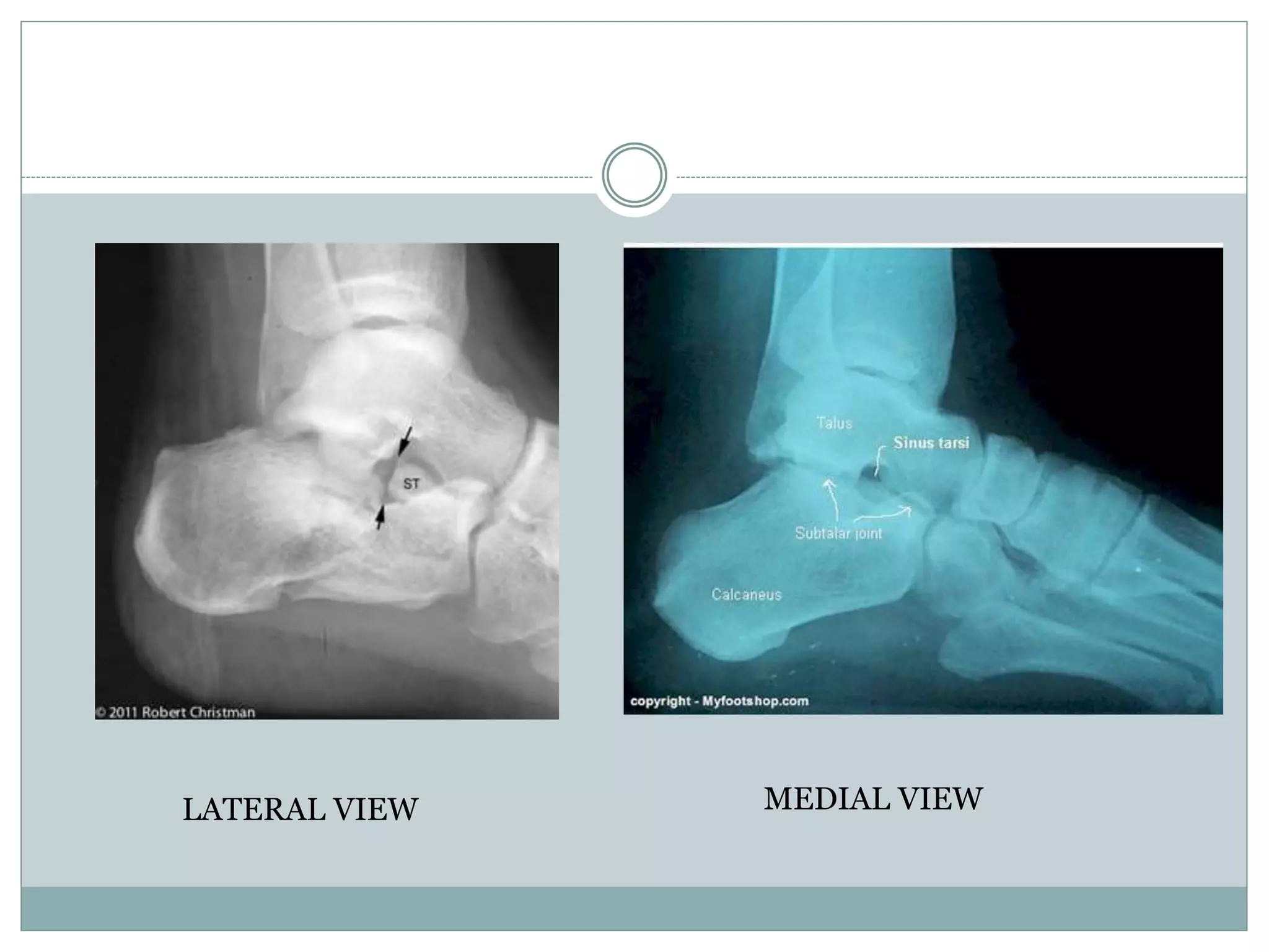Ankle & foot biomechanics | PPTX