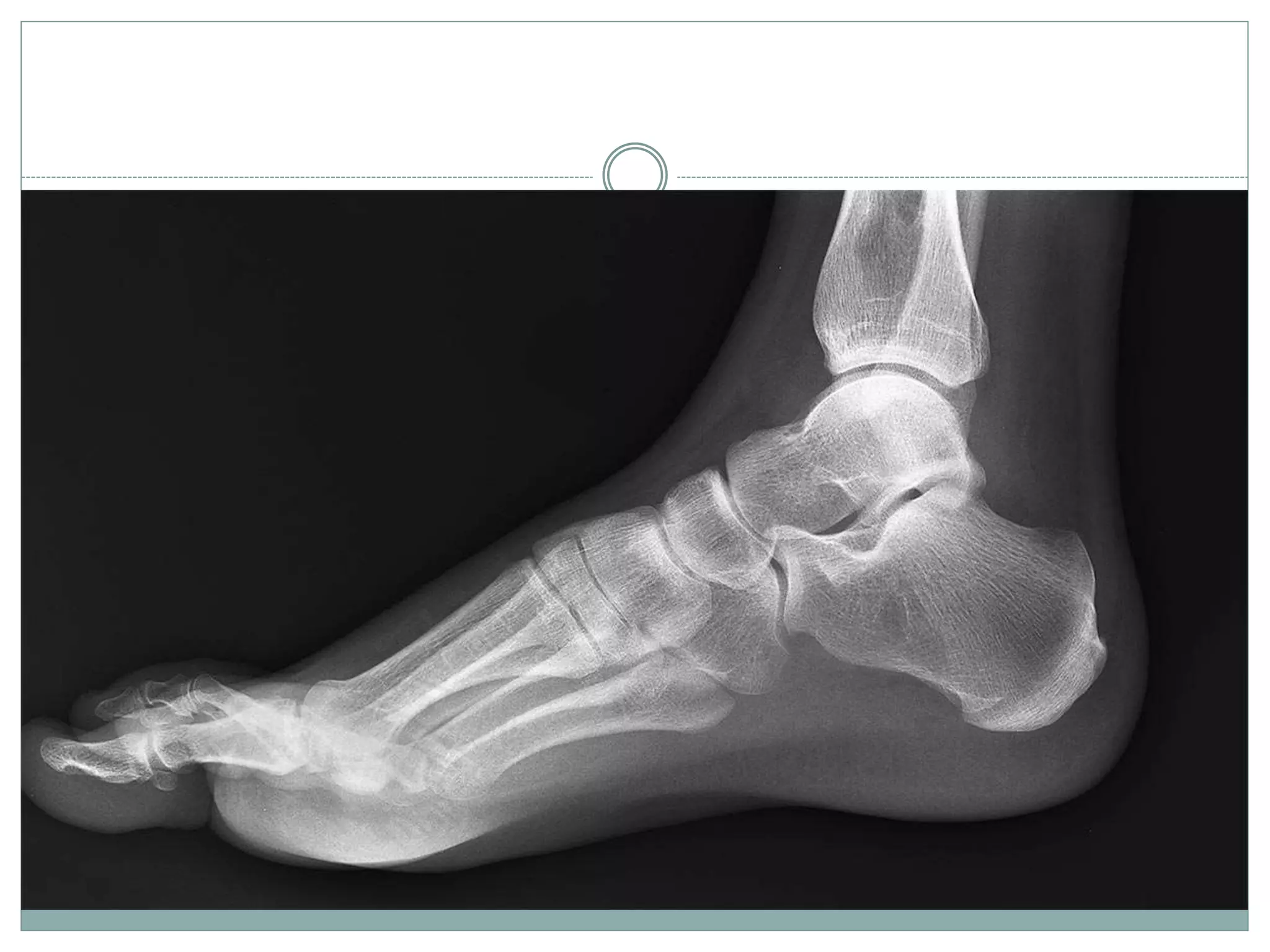 Ankle & foot biomechanics | PPTX