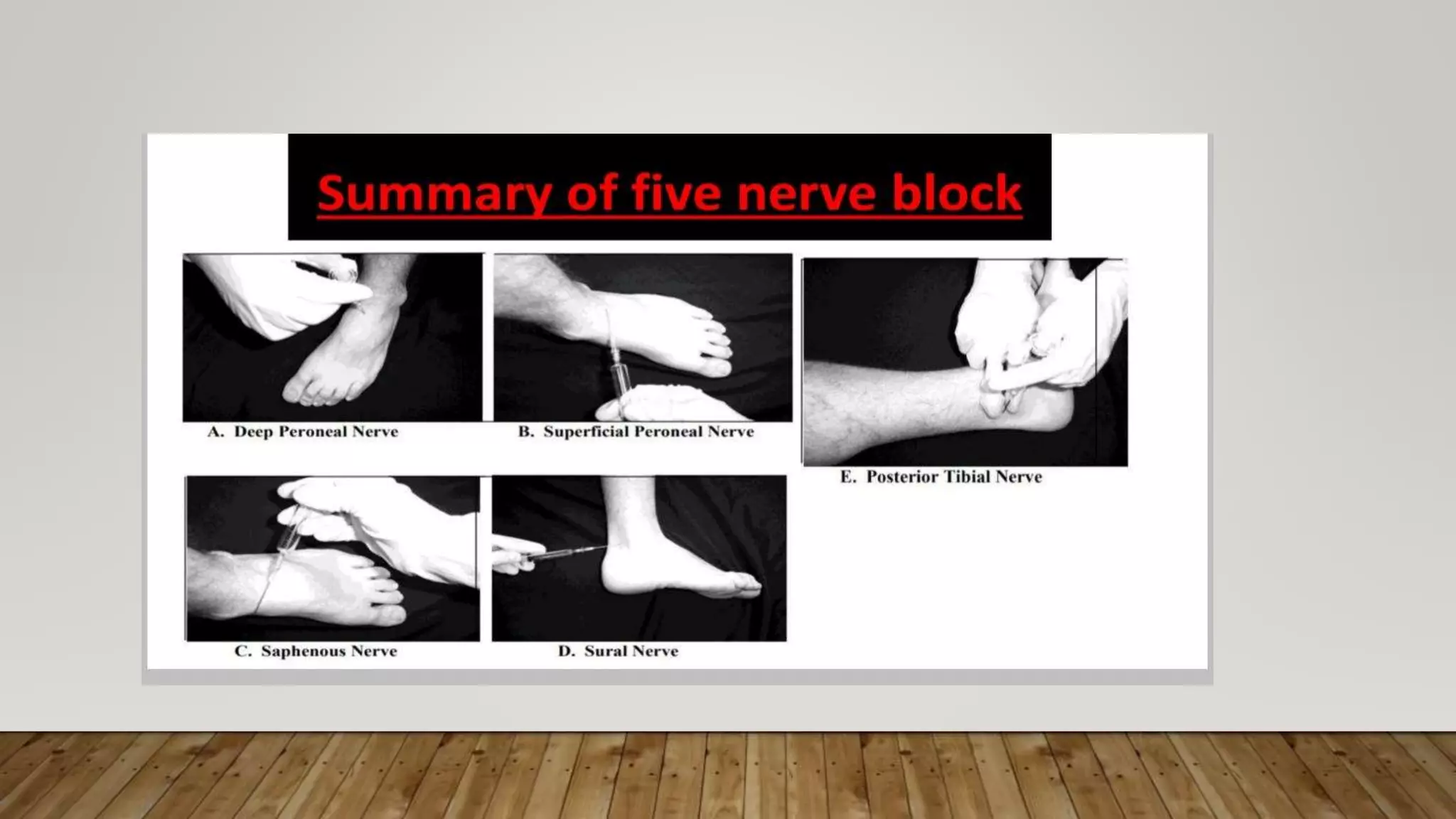 Ankle Foot Block.pptx