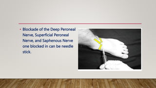 Ankle Foot Block.pptx