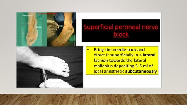 Ankle Foot Block.pptx