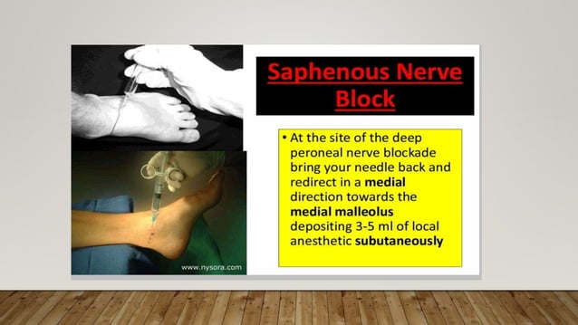 Ankle Foot Block.pptx