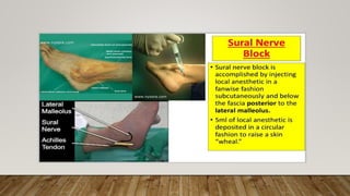 Ankle Foot Block.pptx