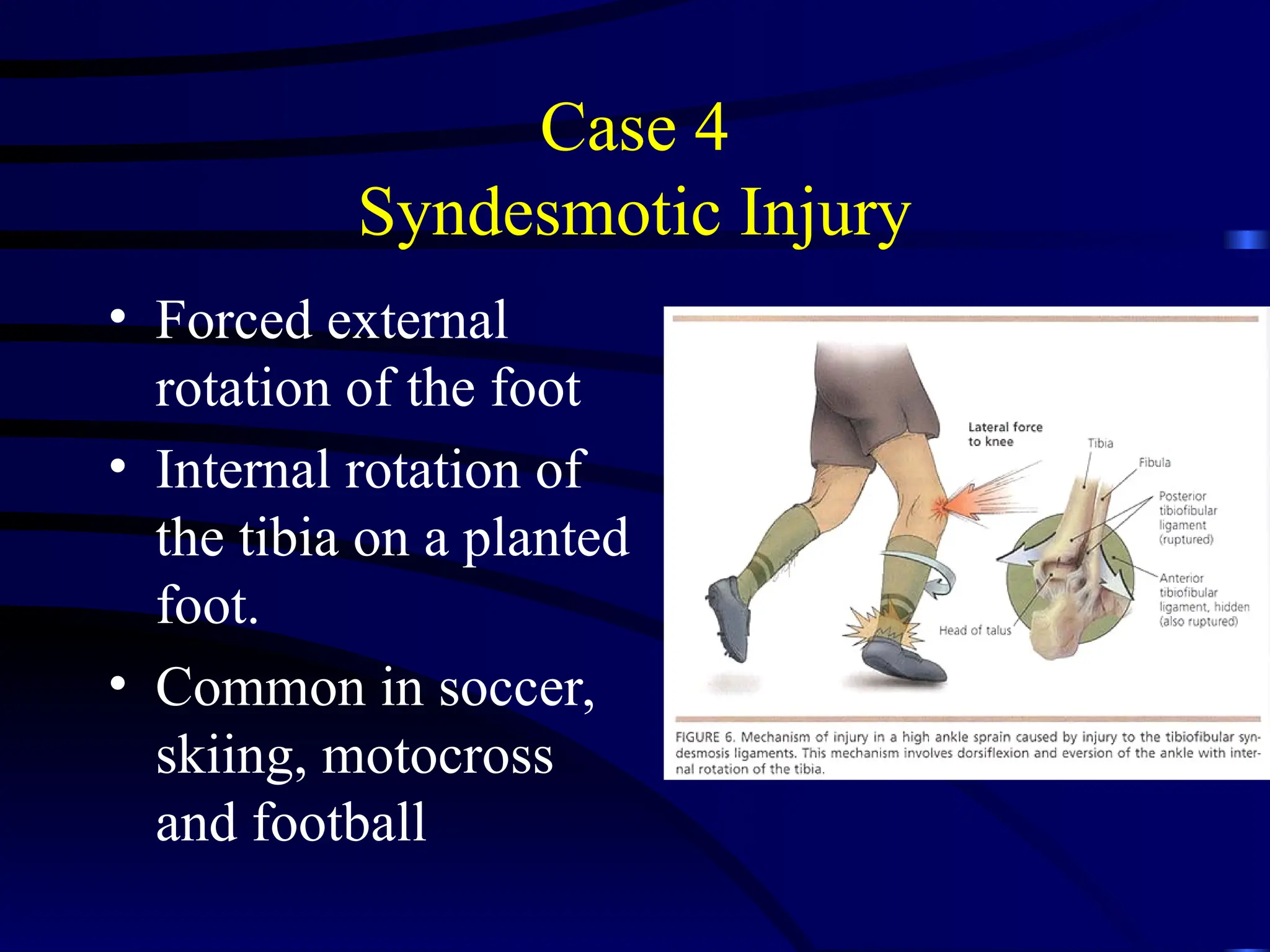 ankle and foot injuries-evaluation and management | PPT
