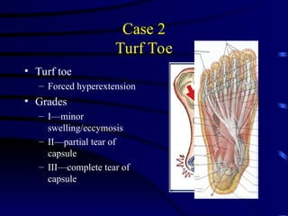 ankle and foot injuries-evaluation and management | PPT