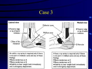 ankle and foot injuries-evaluation and management | PPT