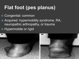 Ankle &foot pain | PPTX