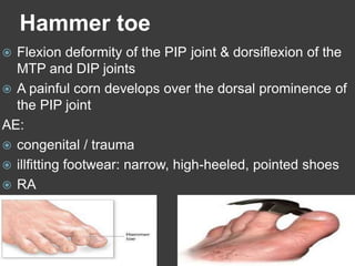 Ankle &foot pain | PPTX