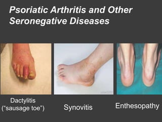 Ankle &foot pain | PPTX