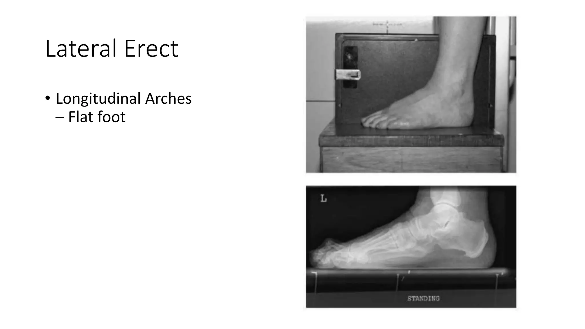 Ankle & Foot Xray & Surgical Approaches | PPTX