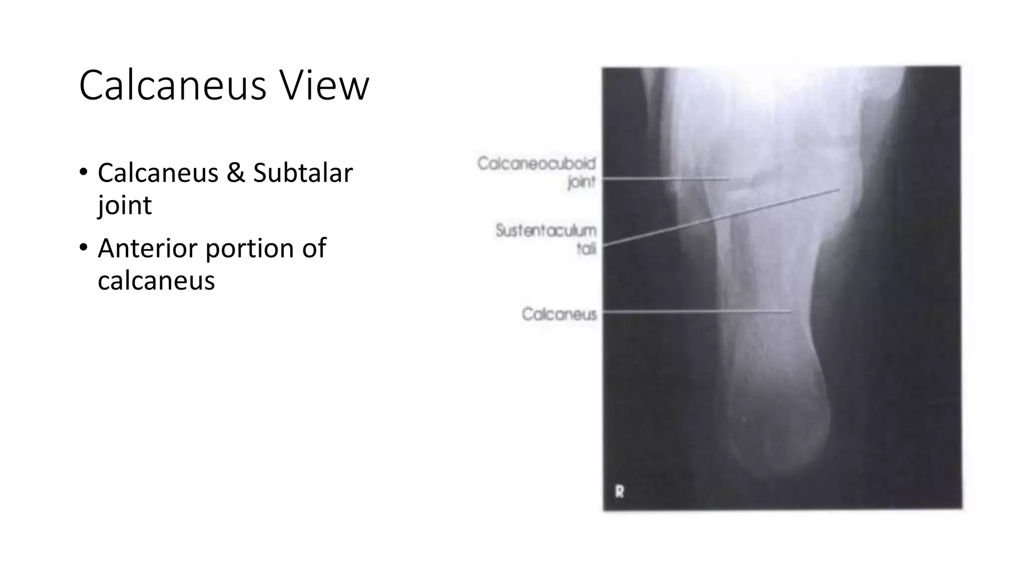 Ankle & Foot Xray & Surgical Approaches | PPTX