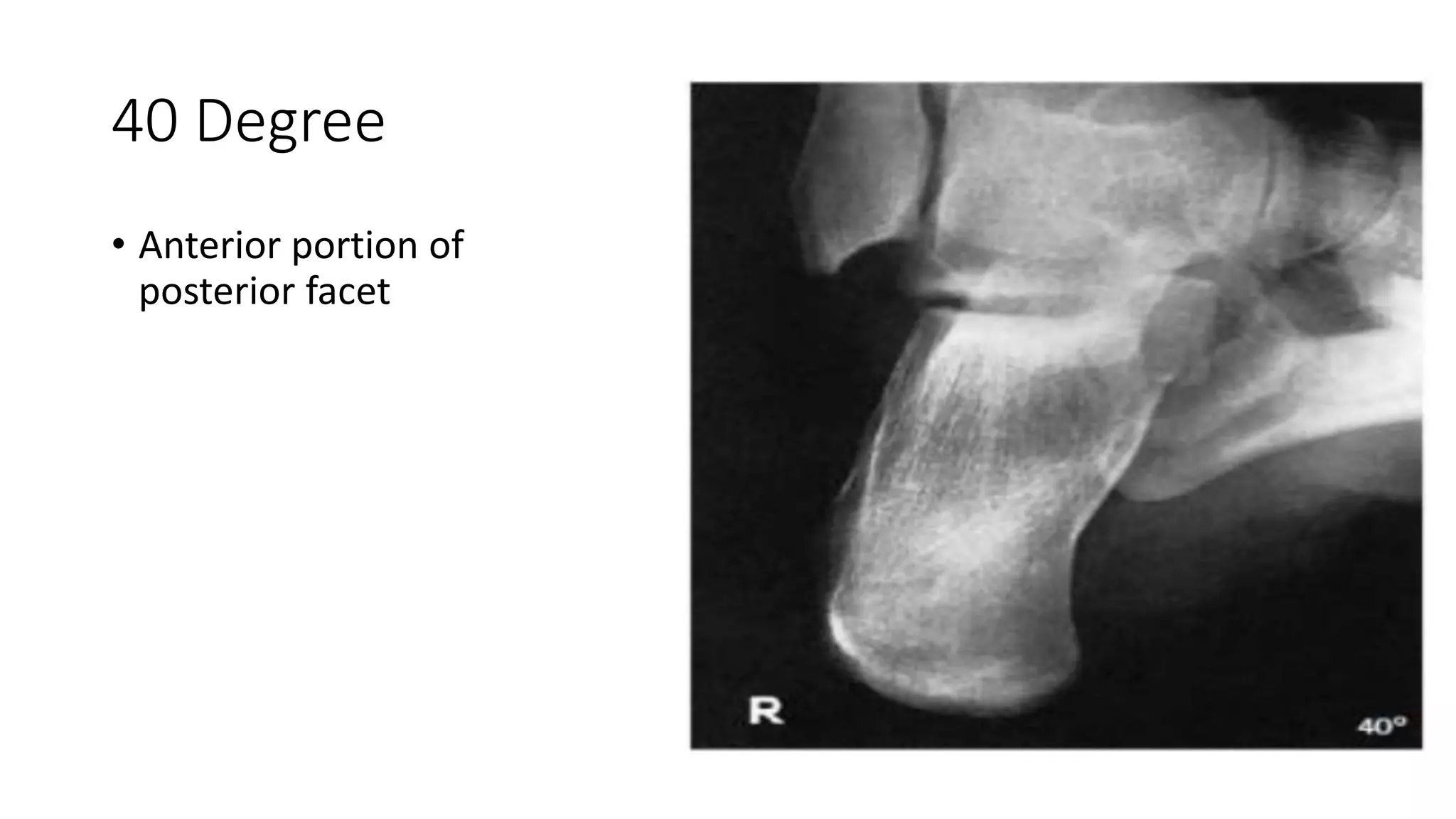 Ankle & Foot Xray & Surgical Approaches | PPTX