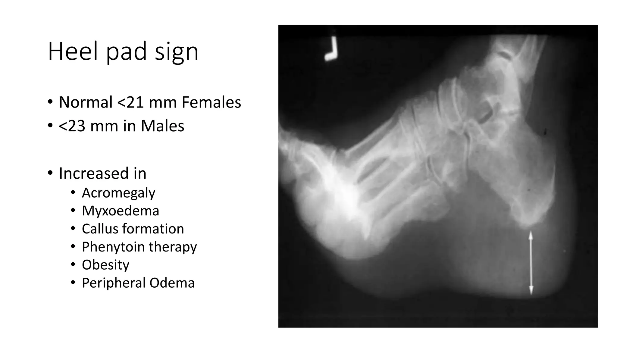 Ankle & Foot Xray & Surgical Approaches | PPTX