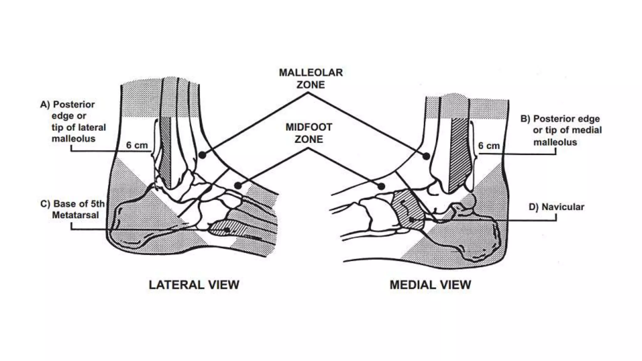 Ankle & Foot Xray & Surgical Approaches | PPTX