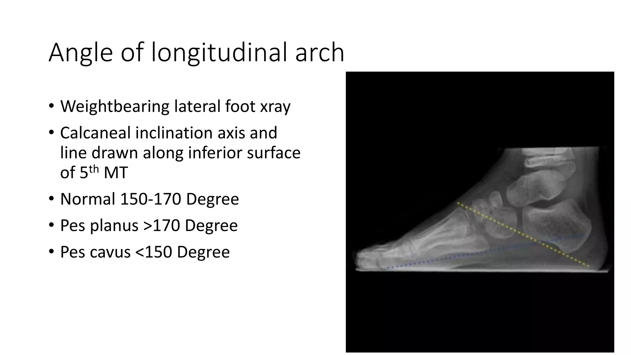 Ankle & Foot Xray & Surgical Approaches | PPTX