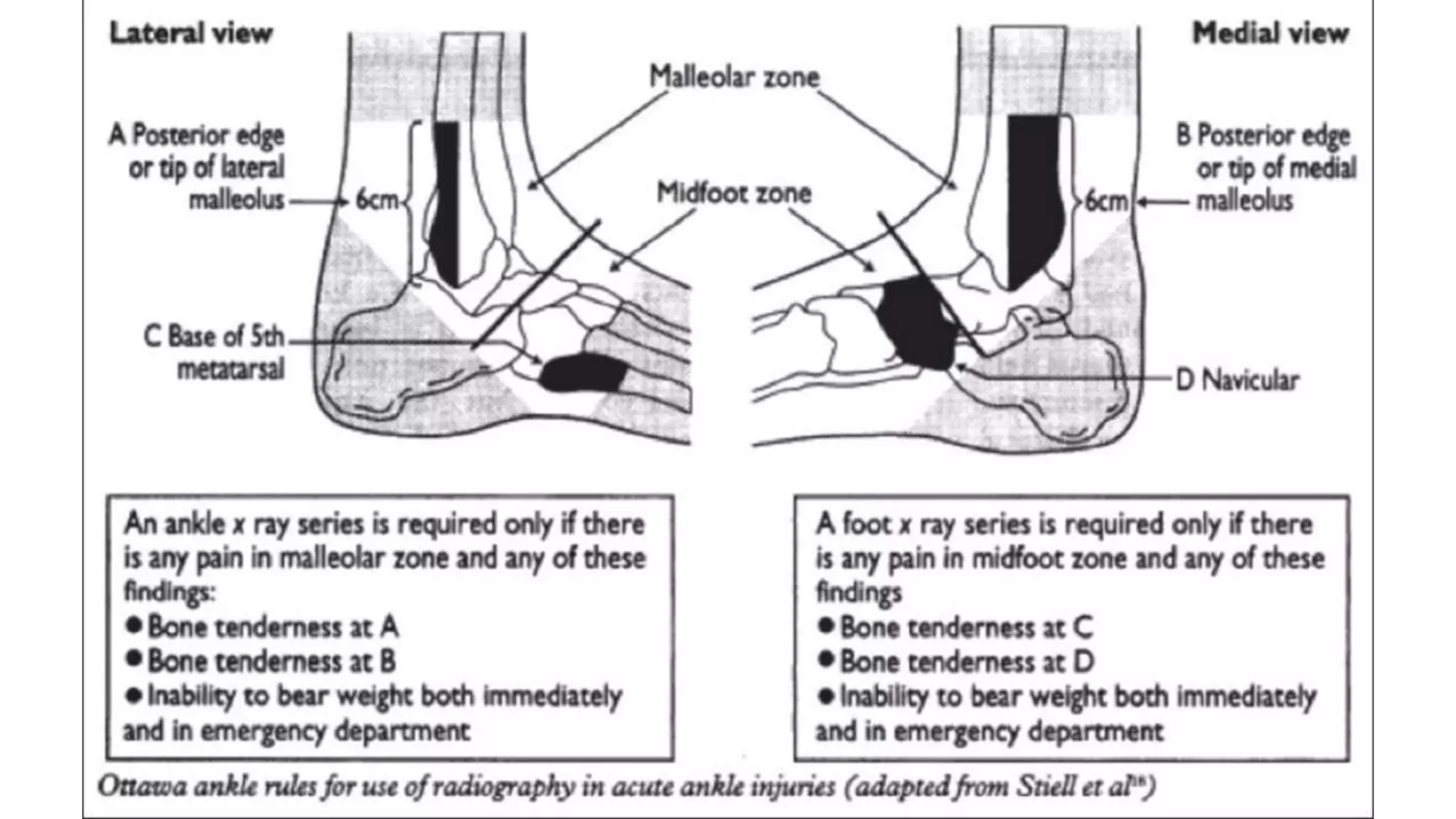Ankle & Foot Xray & Surgical Approaches | PPTX