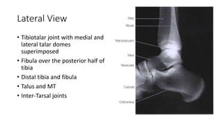 Ankle & Foot Xray & Surgical Approaches | PPTX