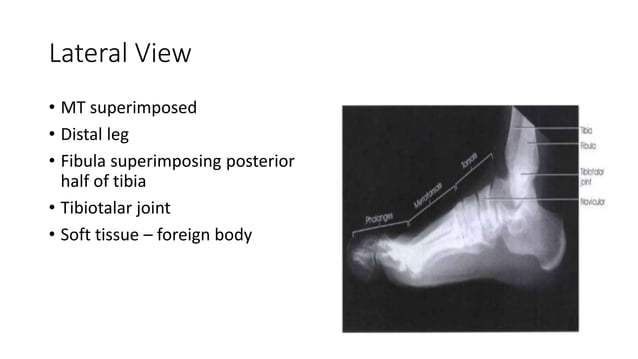 Ankle & Foot Xray & Surgical Approaches | PPTX