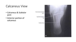 Ankle & Foot Xray & Surgical Approaches | PPTX