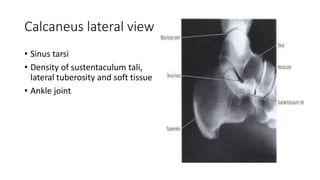 Ankle & Foot Xray & Surgical Approaches | PPTX