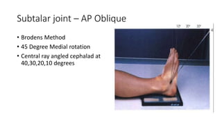Ankle & Foot Xray & Surgical Approaches | PPTX