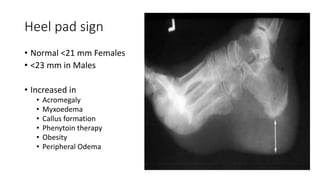 Ankle & Foot Xray & Surgical Approaches | PPTX