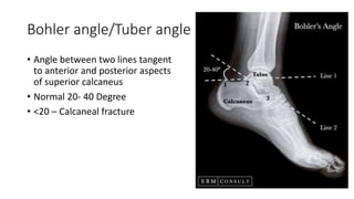 Ankle & Foot Xray & Surgical Approaches | PPTX