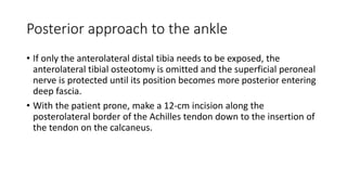 Ankle & Foot Xray & Surgical Approaches | PPTX