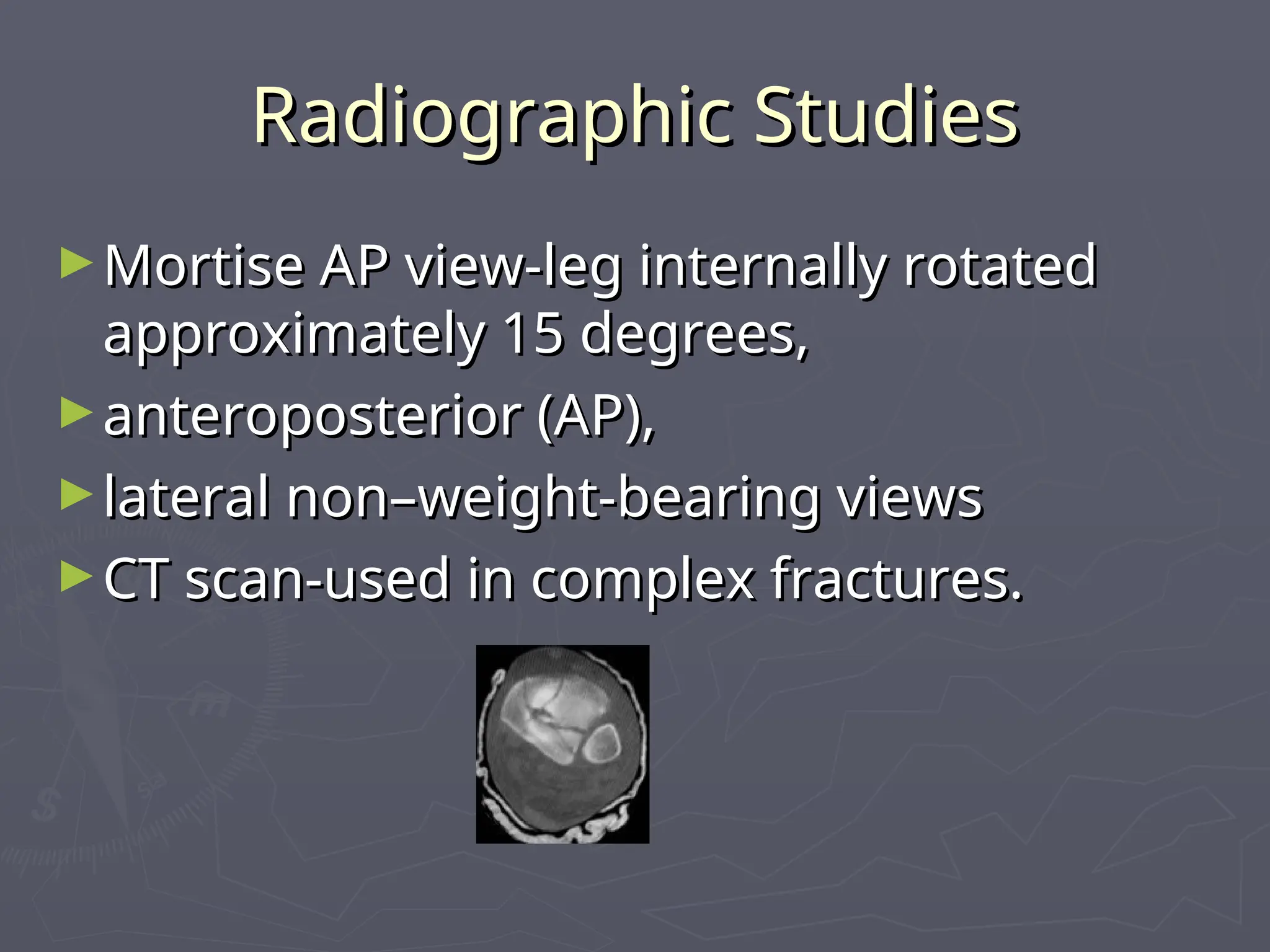 Fracture of the treataNKLE FRACTURE-1.ppt