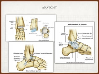 Ankle fracture | PDF