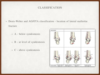 Ankle fracture | PPT