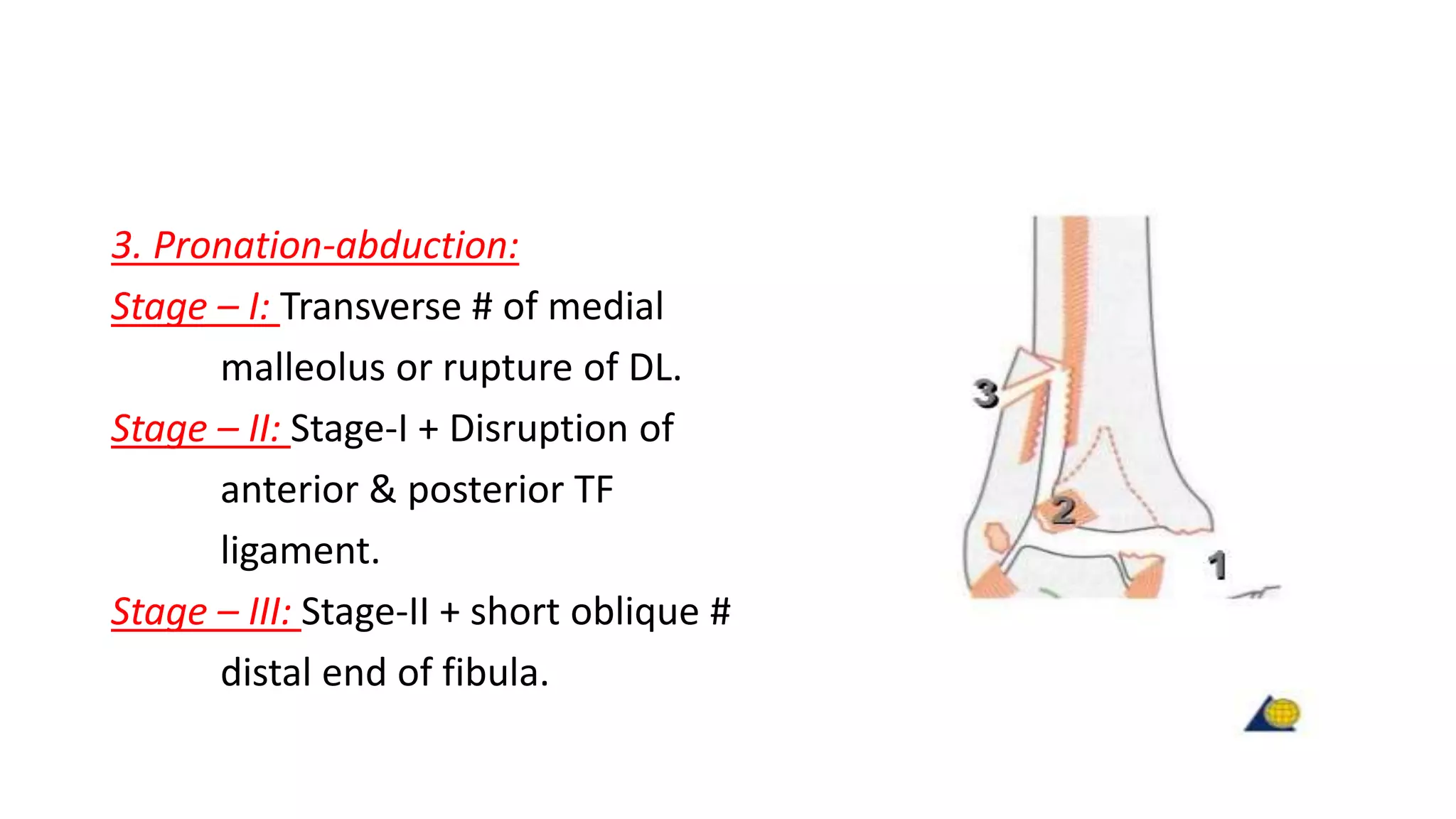 Ankle fracture | PPTX