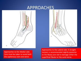 Ankle fracture management | PPTX