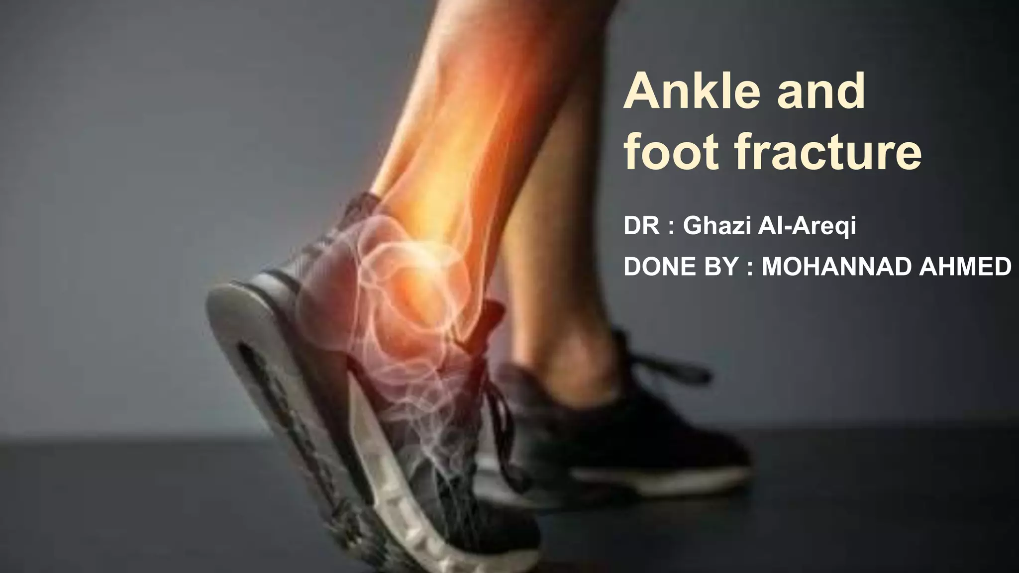 ankle fracture F2.pptx
