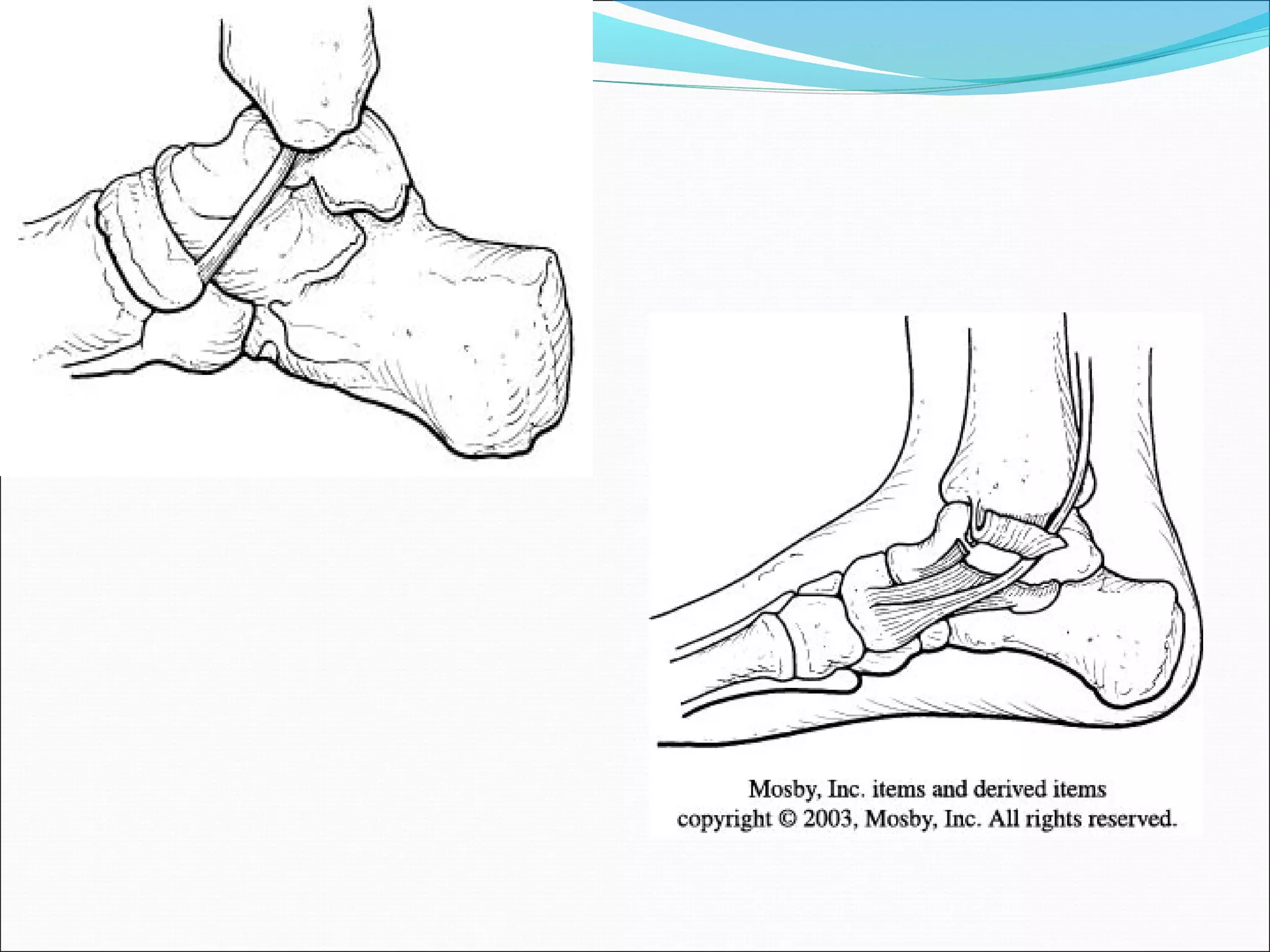 Ankle fractures | PPT