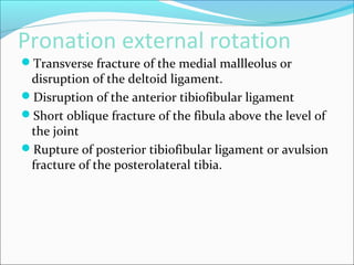 Ankle fractures | PPT