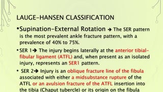 Ankle fractures | PPTX