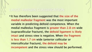 Ankle fractures | PPTX