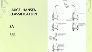Ankle fractures | PPTX