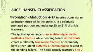 Ankle fractures | PPTX