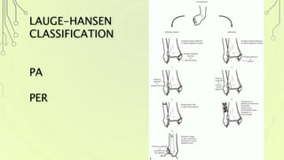 Ankle fractures | PPTX