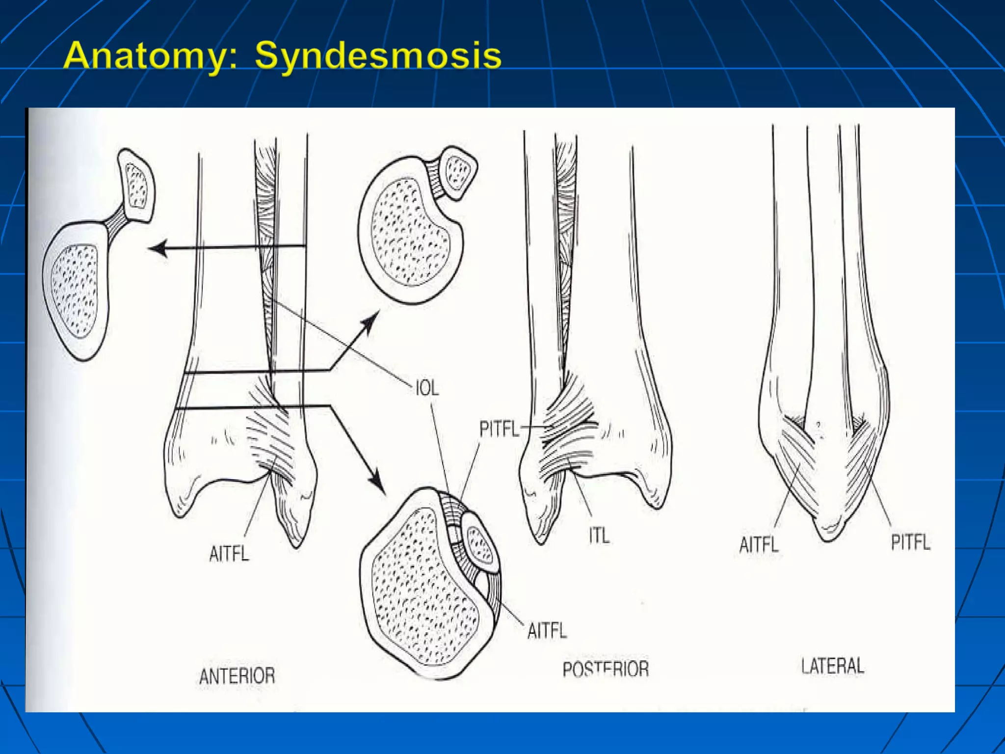 Ankle fractures | PPT