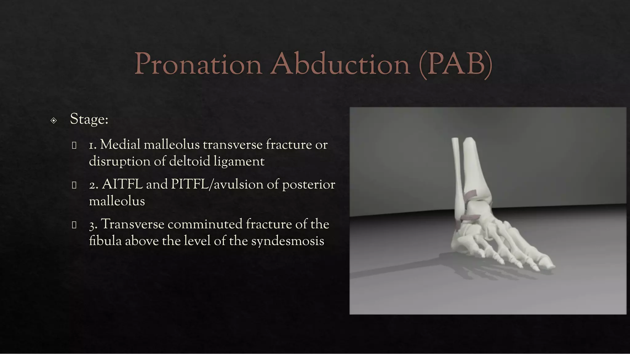 ANKLE FRACTURES.pdf