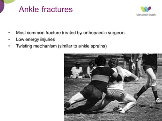 Ankle Fractures.ppt