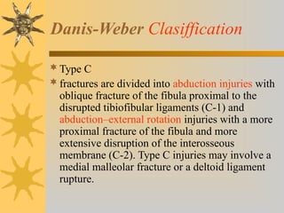 ANKLE FRACTURES, Anatomi, Stability, Main Ligamentous system | PPT