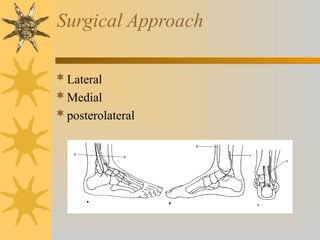 ANKLE FRACTURES, Anatomi, Stability, Main Ligamentous system | PPT